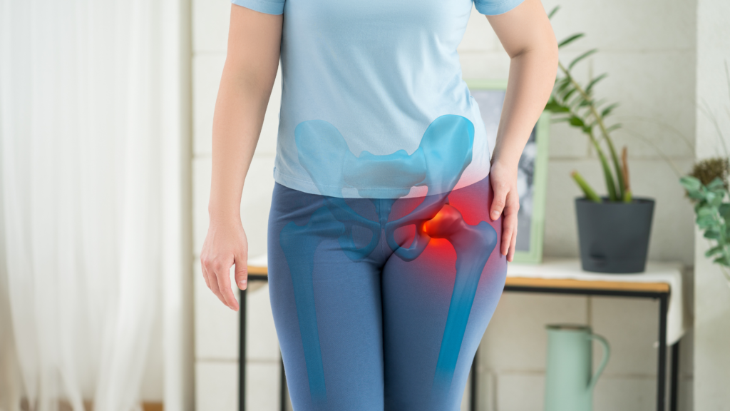 Understanding Hip Bursitis: Causes, Symptoms, and Effective Treatment ...